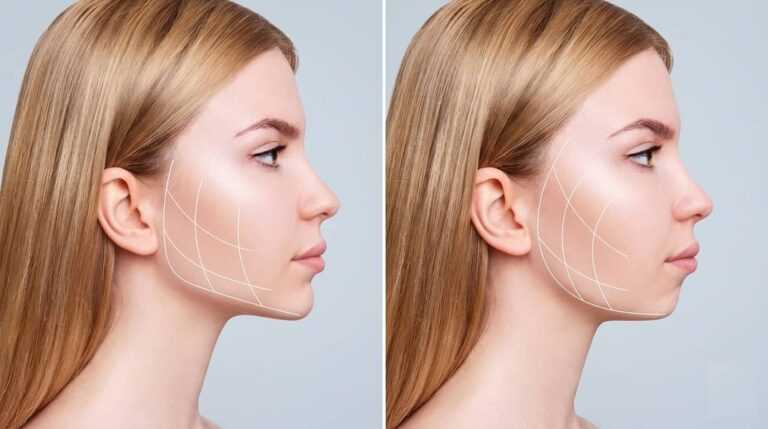 Mewing: What It Is, How to Do It, and Does It Actually Work